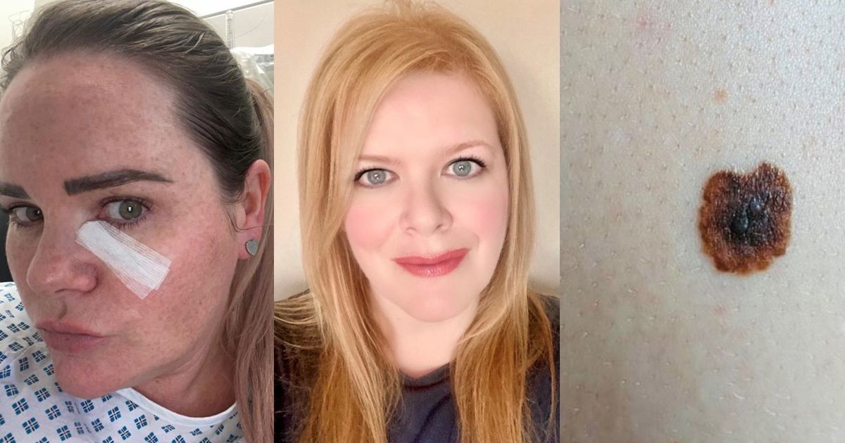 Wirral University Teaching Hospital staff stress the importance of ...