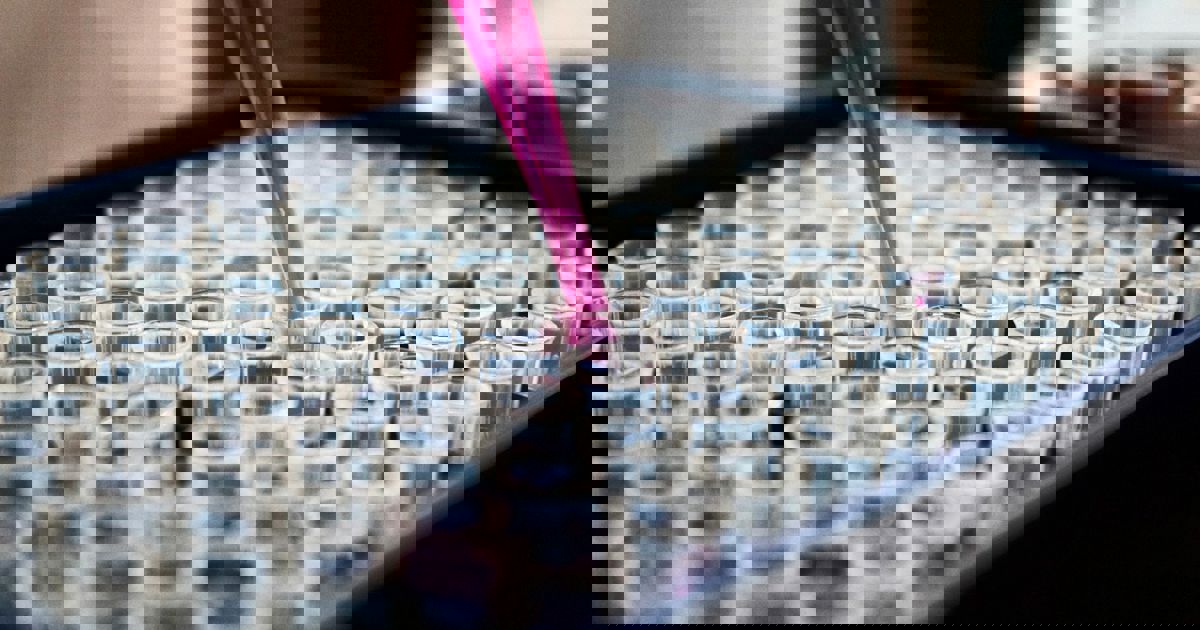 Countess of Chester Hospital unveils Clinical Research Unit and Mobile ...